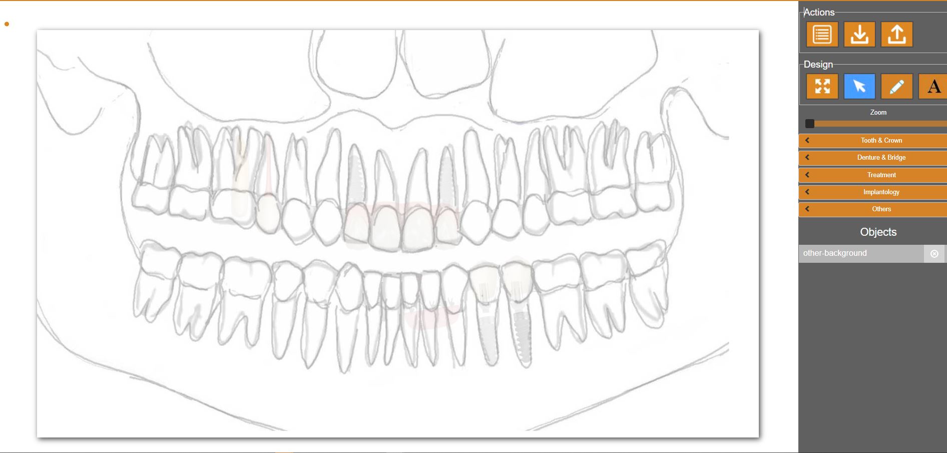 Dental 2 Drawing – The simplified drawing tool