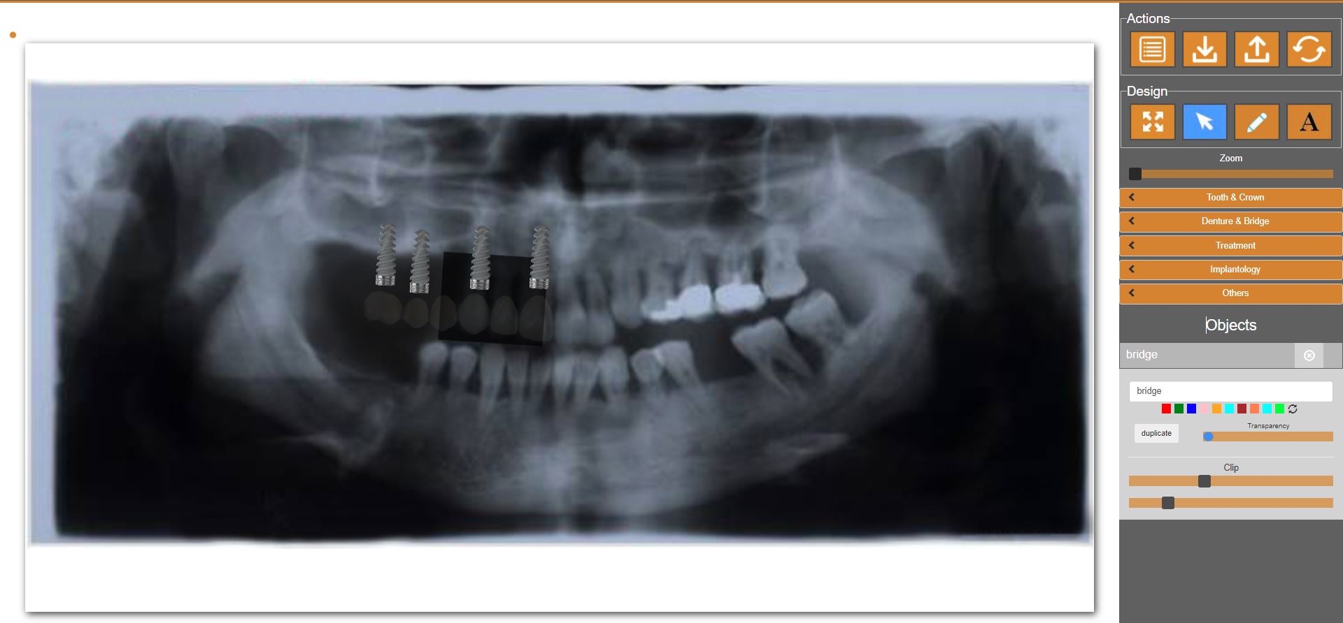 Dental 2 Drawing – The simplified drawing tool