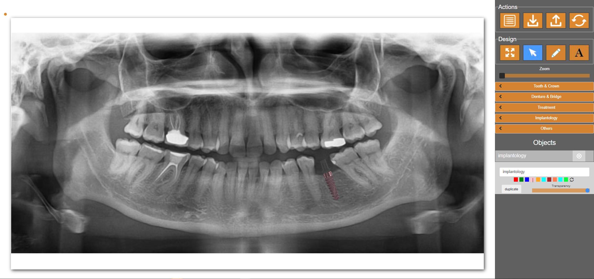 Dental 2 Drawing – The simplified drawing tool