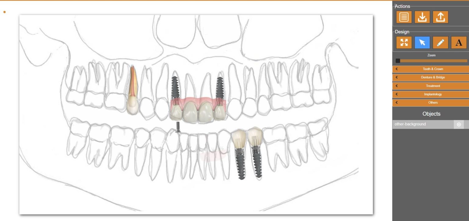 Dental 2 Drawing – The simplified drawing tool